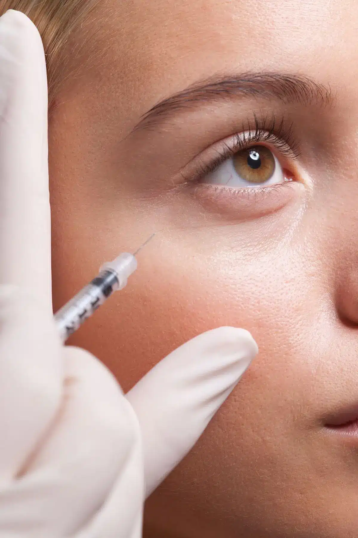 Skin Fillers - Lokare's Dental & Aesthetic Clinic